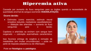 Alteração circulatória: Hiperemia ativa e passiva | PDF