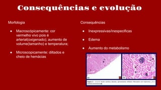 Alteração circulatória: Hiperemia ativa e passiva | PDF