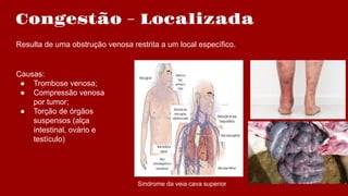 Alteração circulatória: Hiperemia ativa e passiva | PDF
