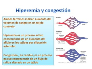 Hiperemia y congestión | PPTX