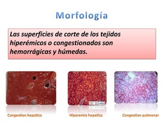 Hiperemia y congestión | PPTX