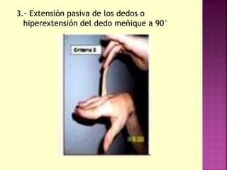 hiperlaxitud.pptx