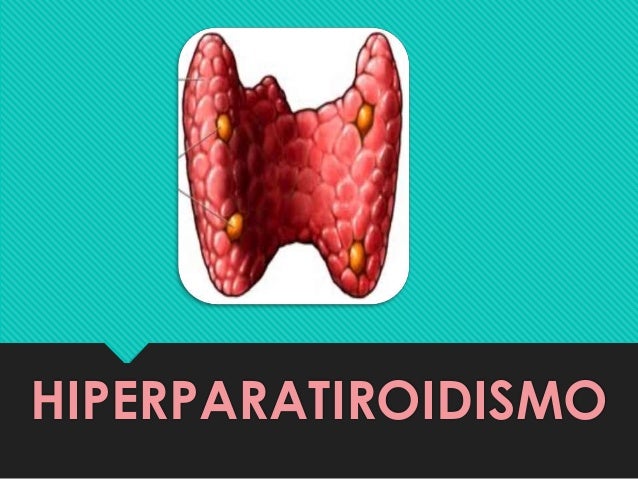 Hiperparatiroidismo