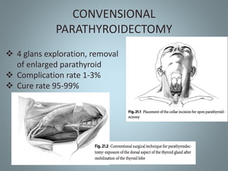 Hiperparathyroid and Kidney Stone | PPTX