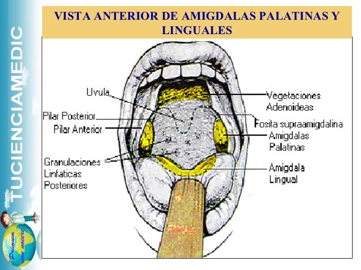 Hiperplasia Benigna De La Adenoides Y De Las Amigdalas Fmh Unprg Tuc…