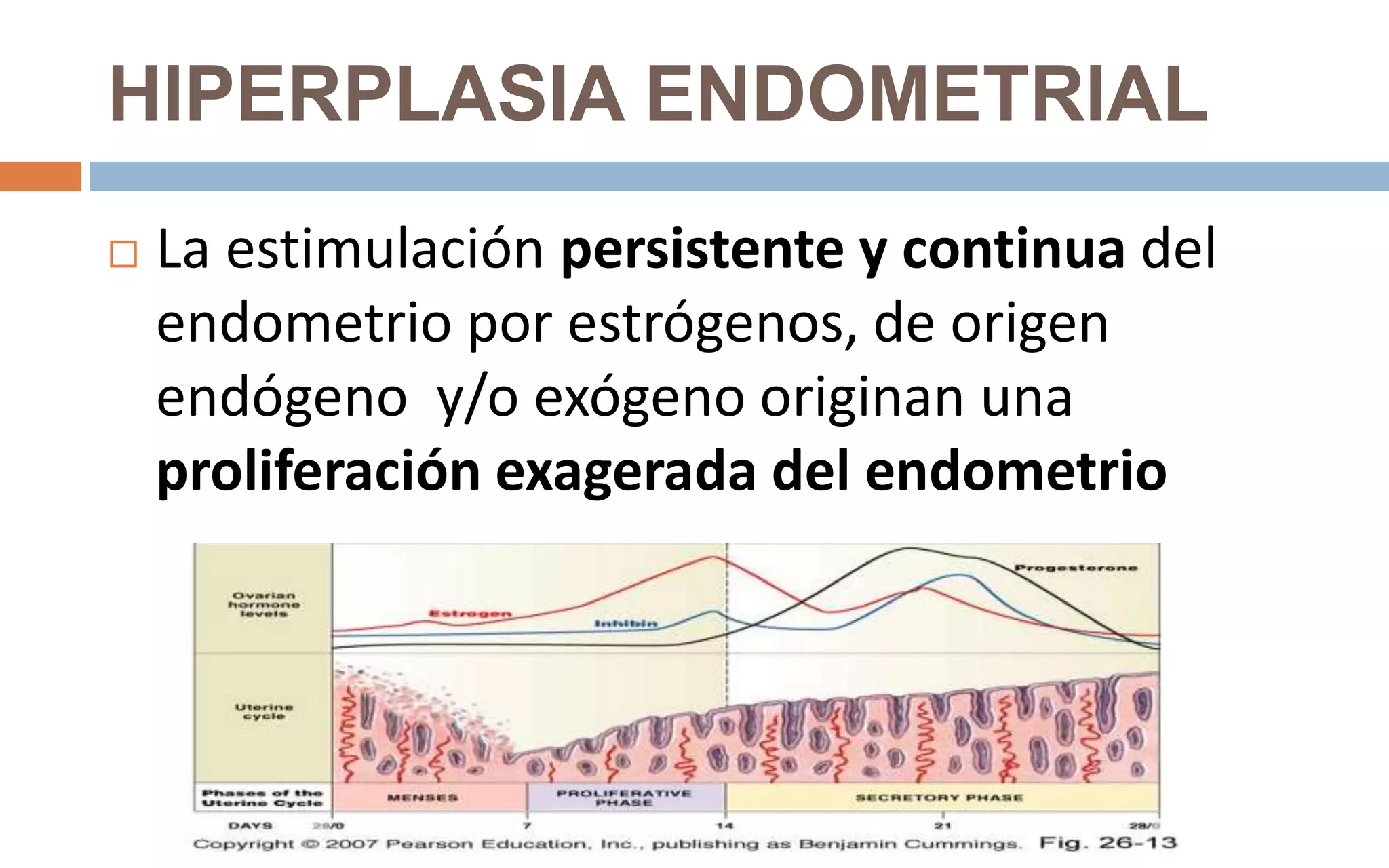Hiperplasia endometrial | PPTX | Endocrine and Metabolic Diseases ...