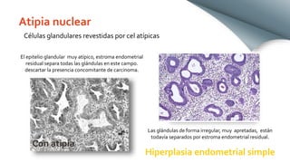 Hiperplasia endometrial | PPTX