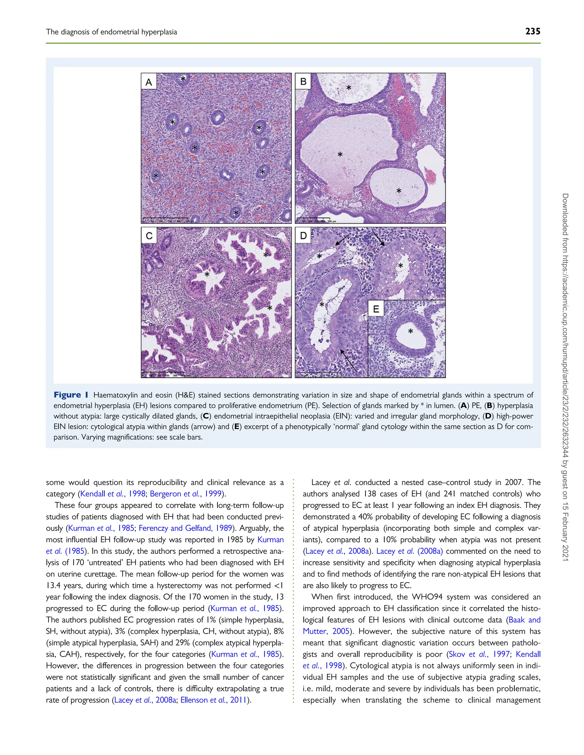 HIPERPLASIA+ENDOMETRIAL+ART%C3%8DCULO+1.pdf