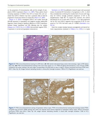 HIPERPLASIA+ENDOMETRIAL+ART%C3%8DCULO+1.pdf