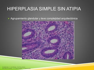 Hiperplasia endometrial (neoplasia intraepitelial endometrial | PPTX