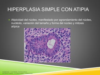 Hiperplasia endometrial (neoplasia intraepitelial endometrial | PPTX