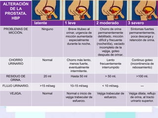 Hiperplasia Prostatica Pptx