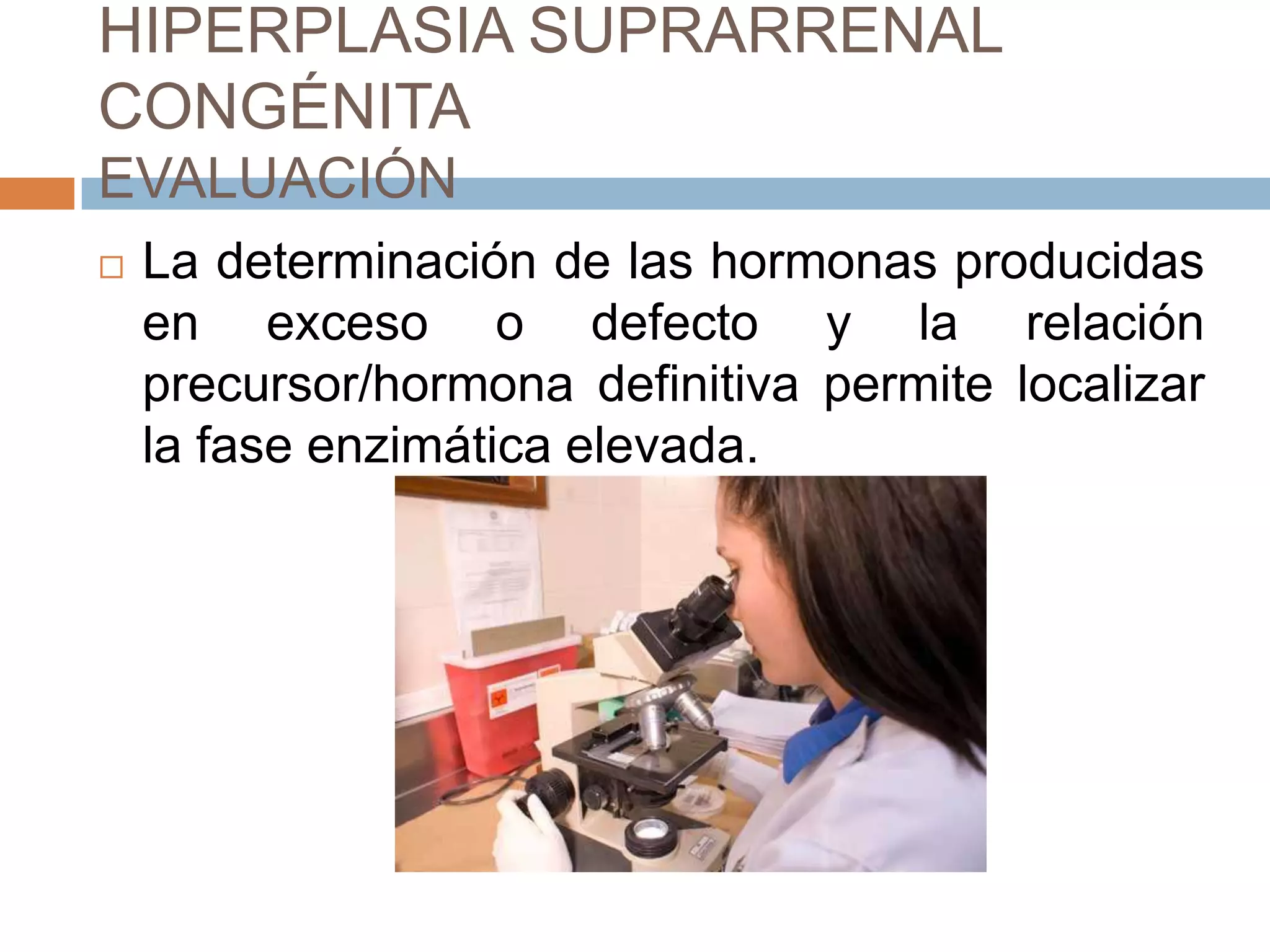 Hiperplasia suprarrenal congénita | PPTX
