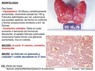 Hiperplasia tiroidea | PPT
