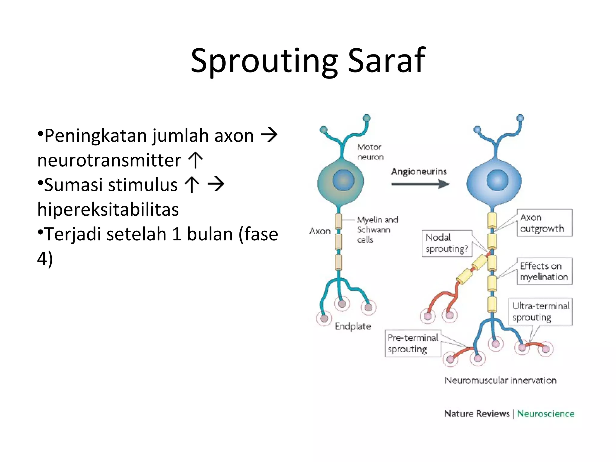 Hiperpolarisasi neuron sebagai patofisiologi fase arefleksia pada lesi ...