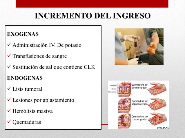 Hiperpotasemia | PPTX | Endocrine and Metabolic Diseases | Diseases and ...