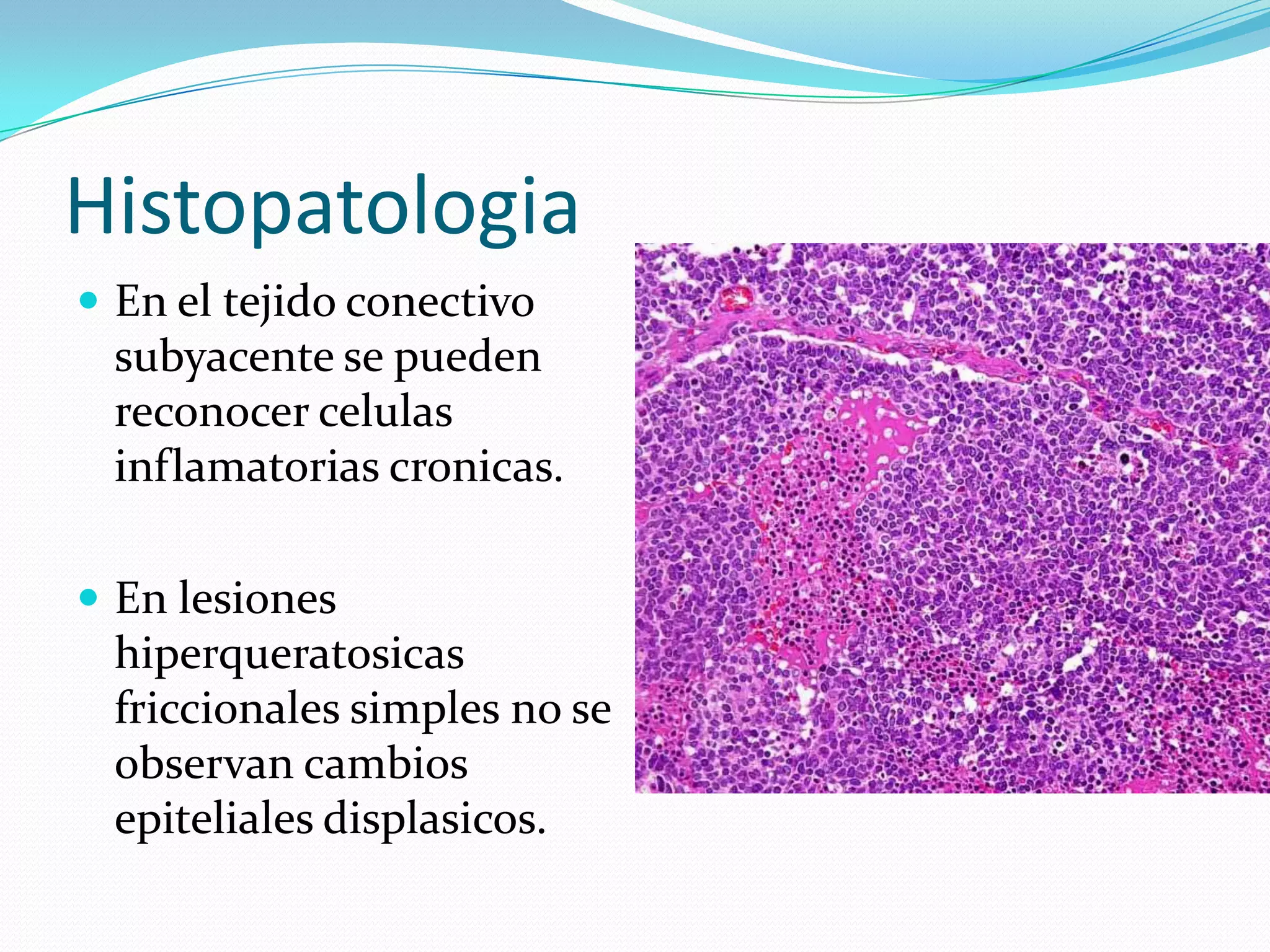 Hiperqueratosis focal (friccional) | PPT
