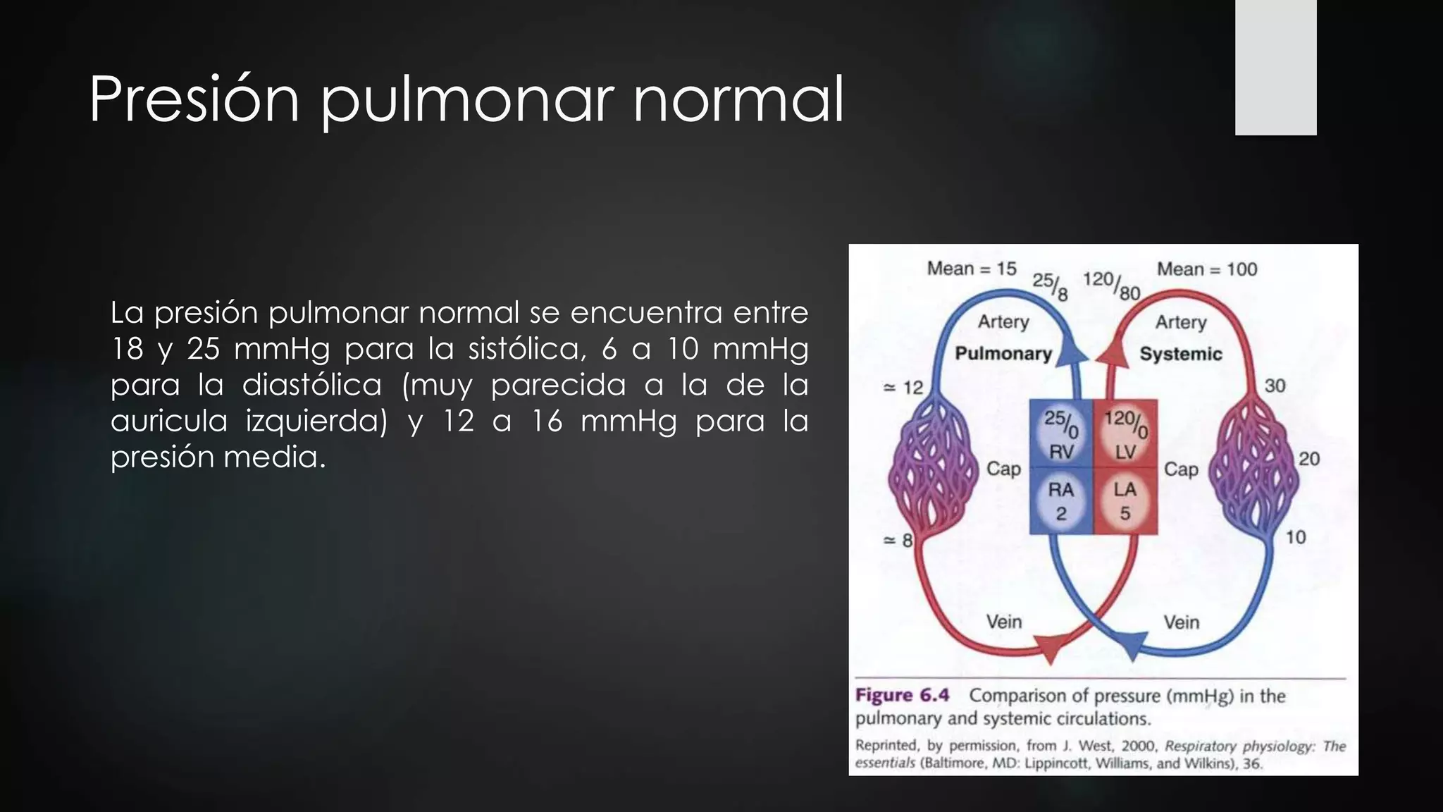 Hipertensión pulmonar. Fisiopatologia, Clasificacion, Diagnostico y ...