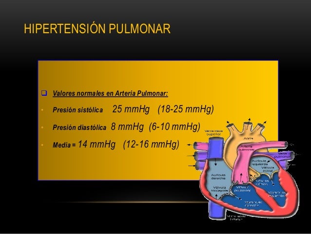 Hipertension pulmonar