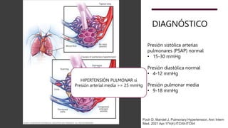 Hipertension pulmonar.pptx