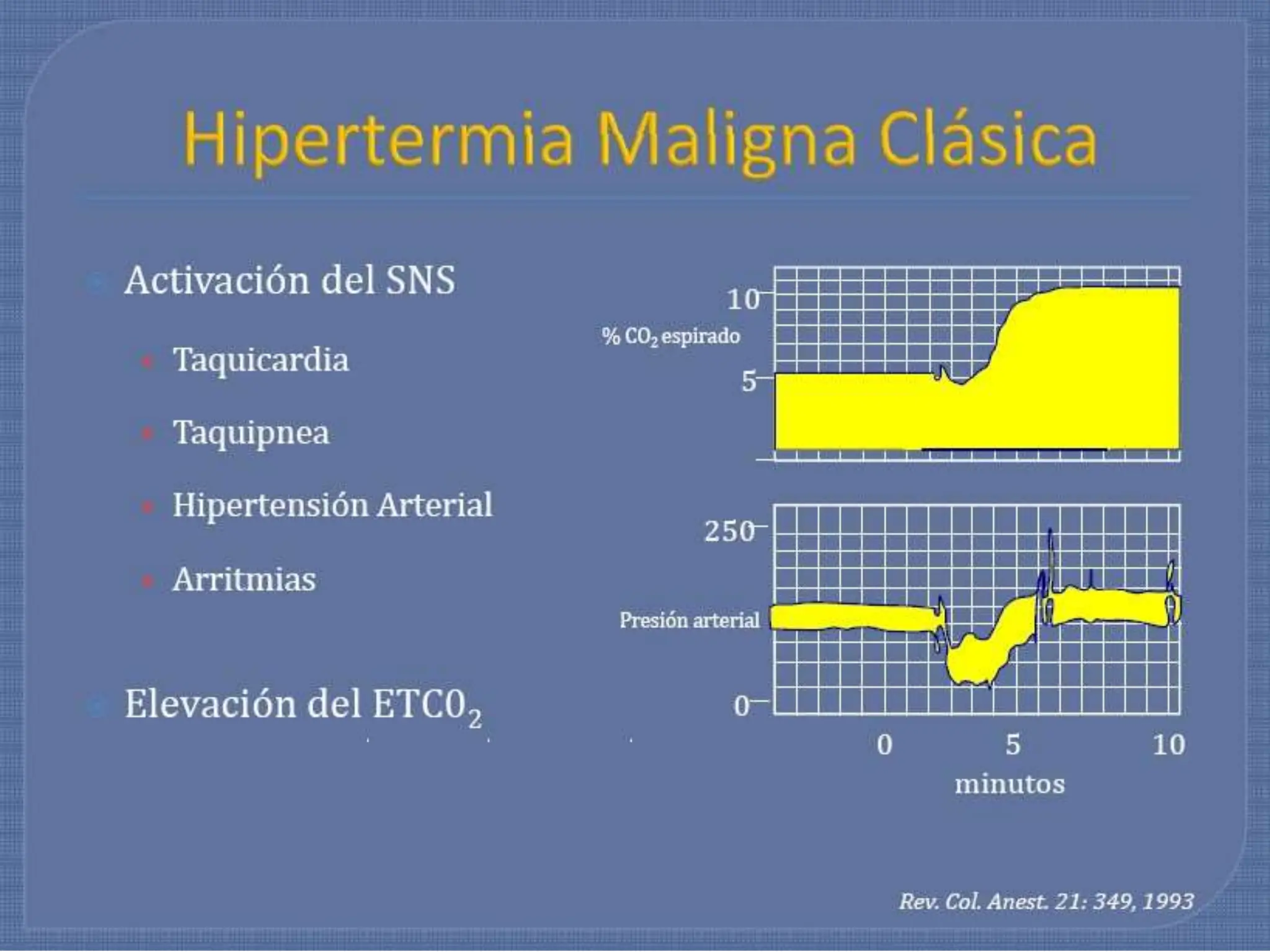 Hipertermia-Maligna presentacion.pptx