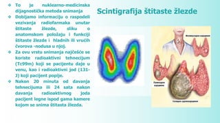 Hipertireoza | PPTX