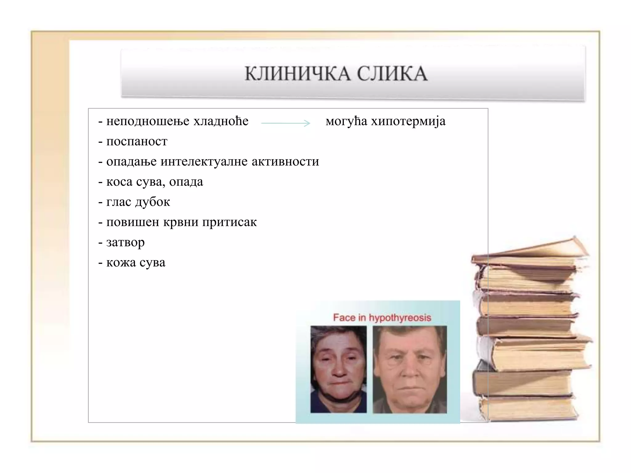 Hipertireoza i hipotireoza | PPTX