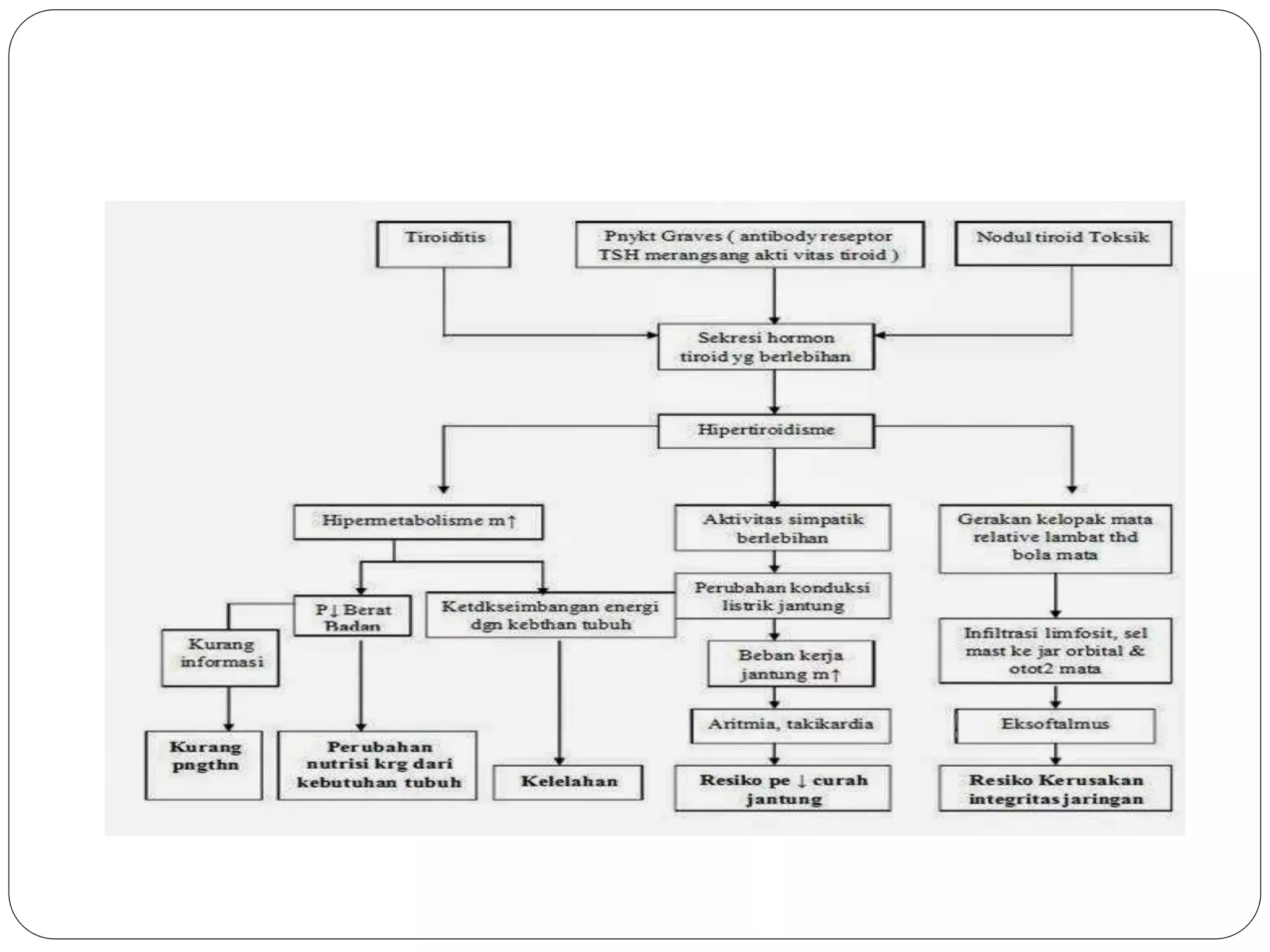 Hipertiroid dan Hipotiroid | PPTX