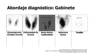 HIPERTIROIDISMO.pptx