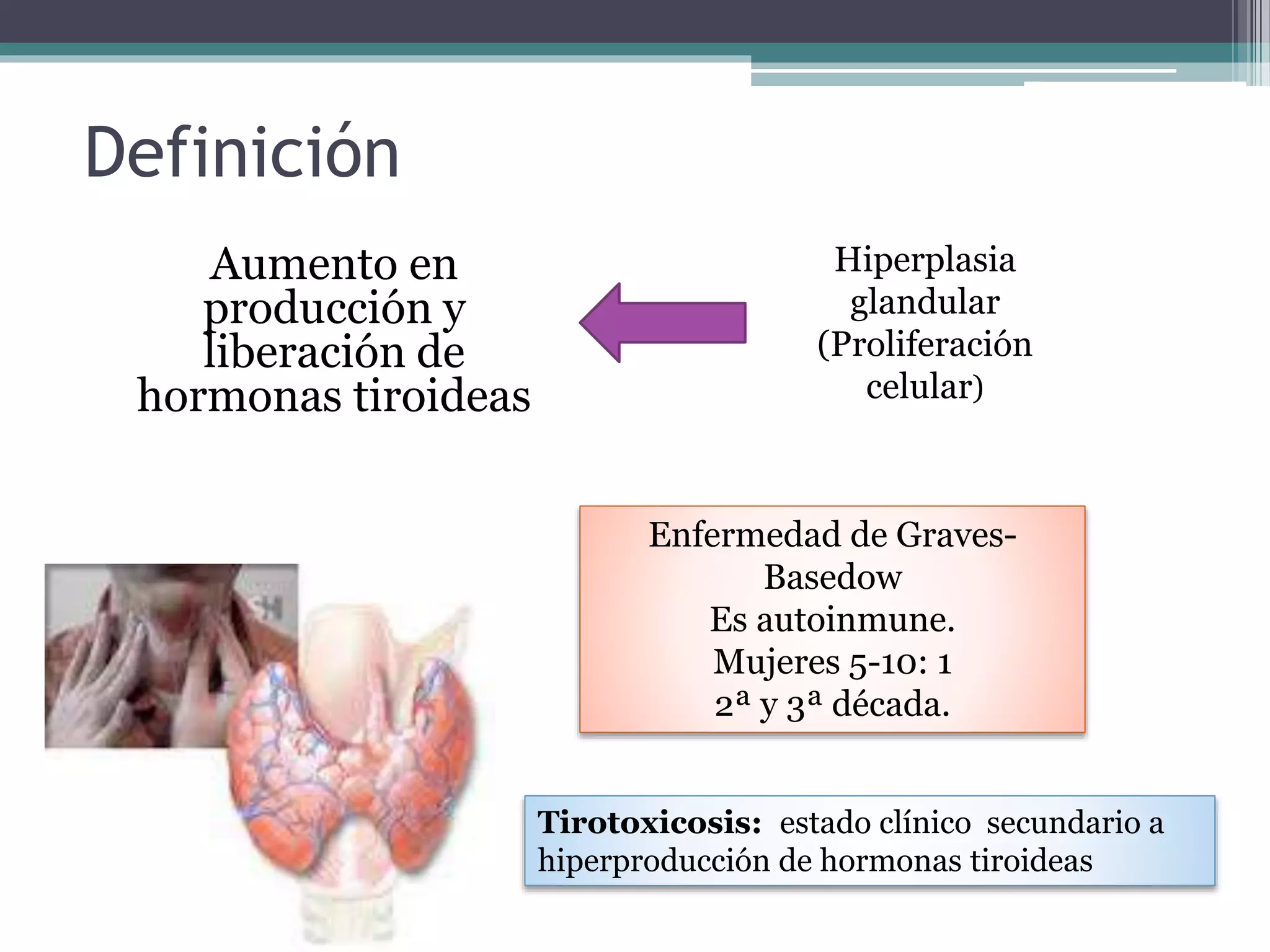 Hipertiroidismo enfermedad de graves- basedow perry | PPTX