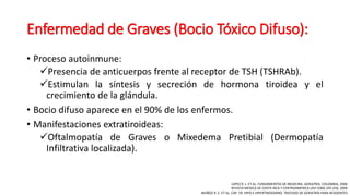 Hipertiroidismo en el adulto mayor | PPTX