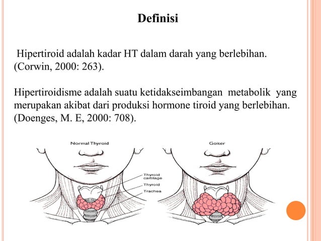 Hipertiroid ppt | PPTX