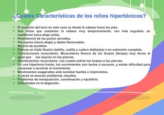 HIPERTONIA.pdf