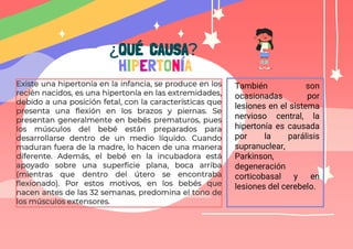 HIPERTONIA - Leyda Vega.pdf