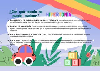 HIPERTONIA - Leyda Vega.pdf