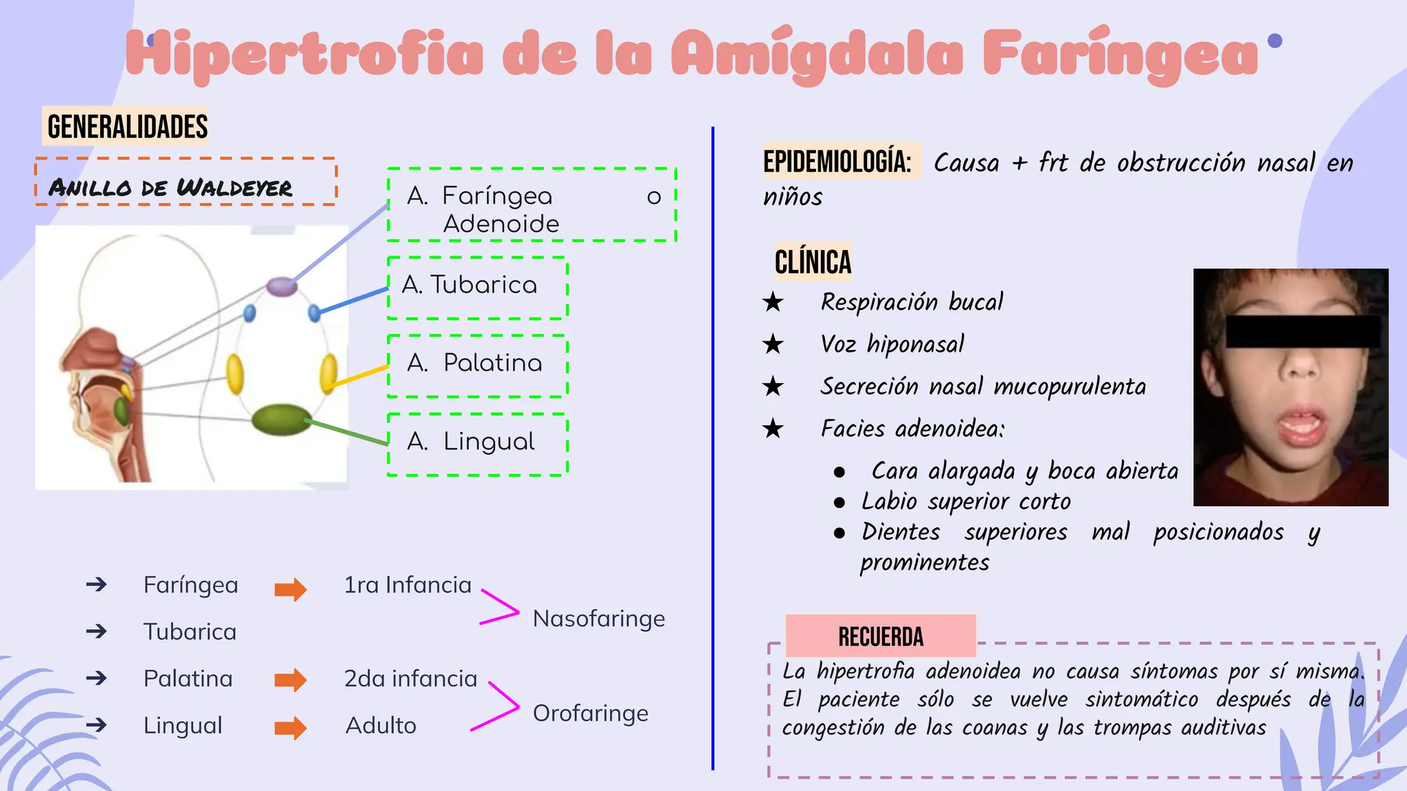 HIPERTROFIA DE AMIGDALA FARINGEA O ADENOIDES | PDF