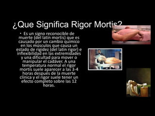 Hipertrofia muscular y rigor mortis | PPTX