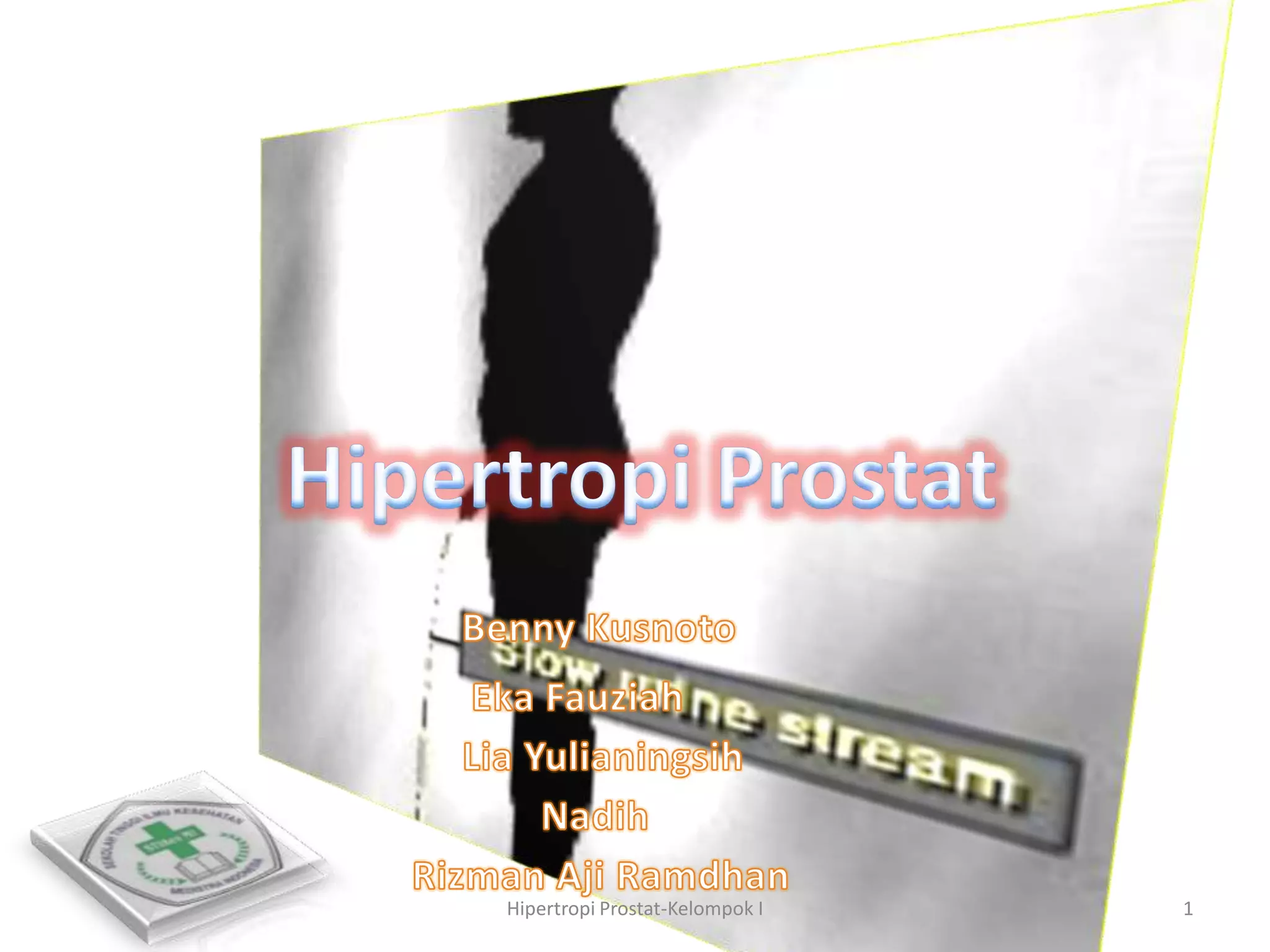 Hipertropi prostat | PPTX