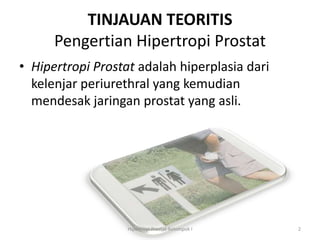 Hipertropi prostat | PPTX