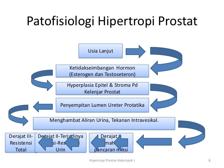 Hipertropi prostat