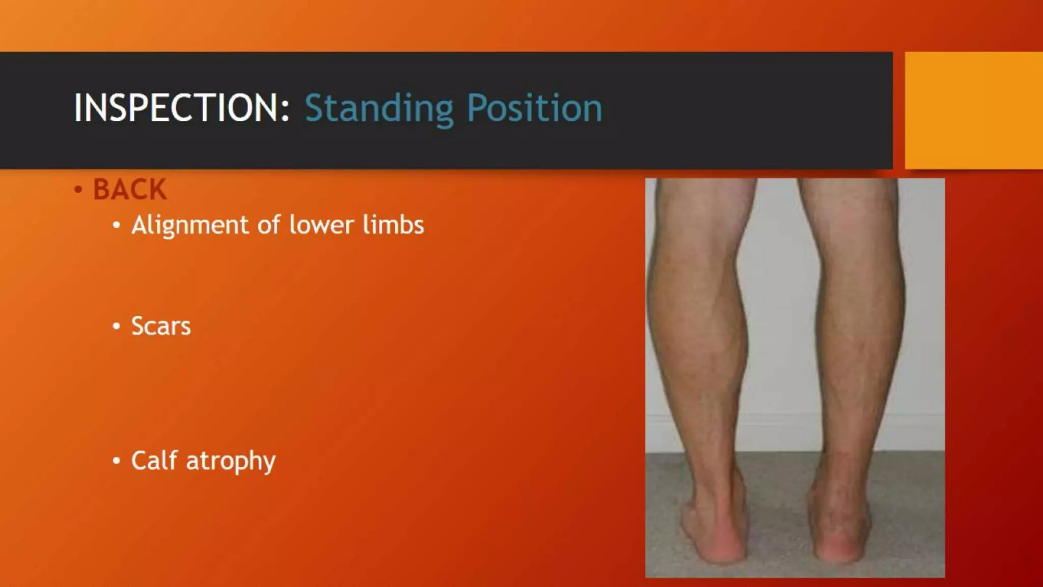 Hip examination - Dr Piyush | PPTX