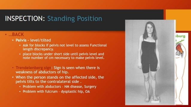 Hip examination - Dr Piyush | PPTX