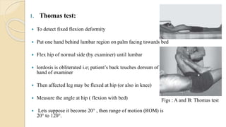 Hip examination | PPTX | Death, Injury, or Military Conflict ...