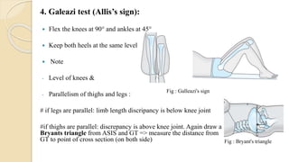 Hip examination | PPTX | Death, Injury, or Military Conflict ...