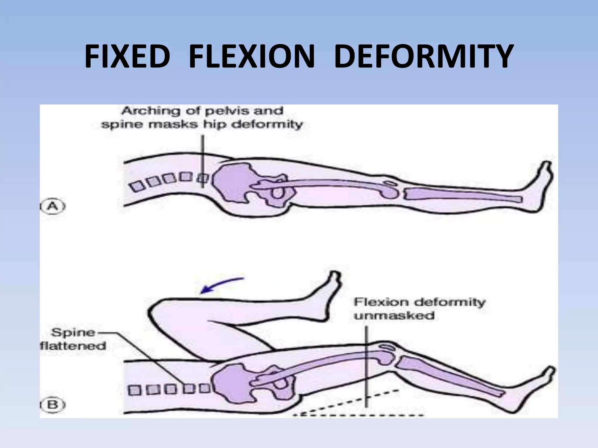 CLINICAL EXAMINATION OF HIP JOINT | PPTX