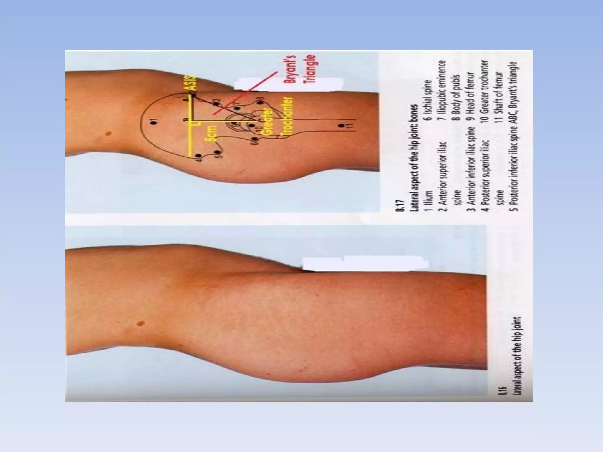 CLINICAL EXAMINATION OF HIP JOINT | PPTX