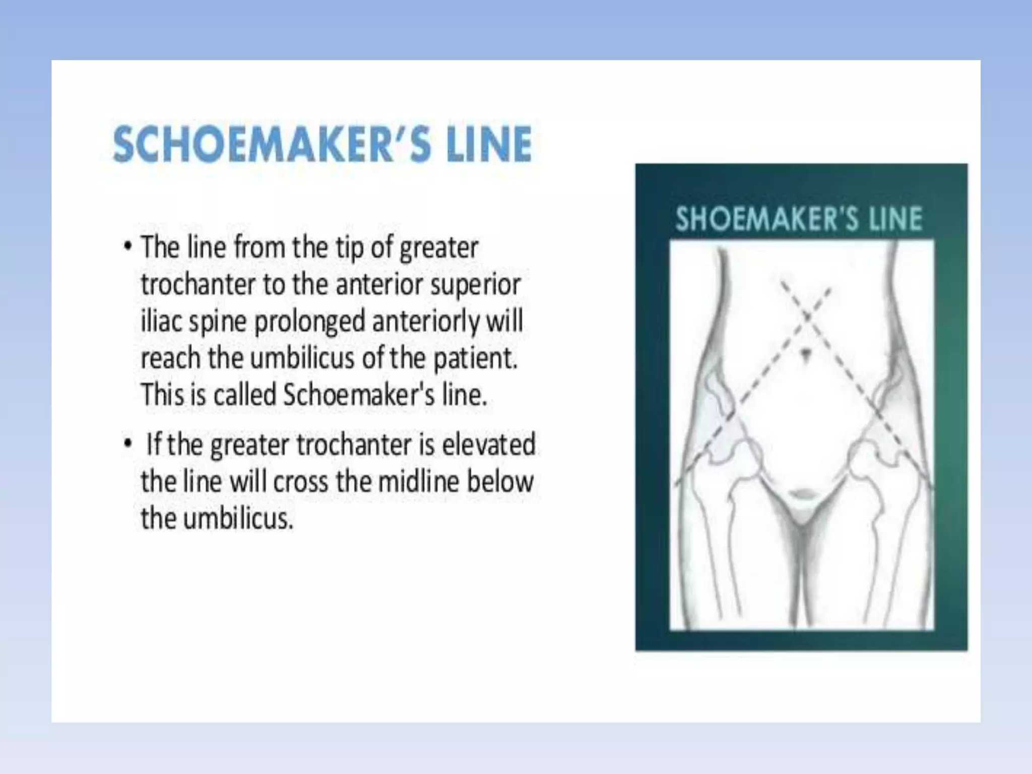 CLINICAL EXAMINATION OF HIP JOINT | PPTX