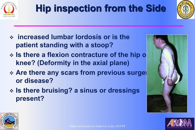 Hip examination | PPT