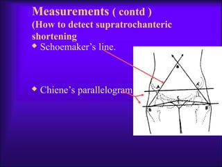 HIP_EXAMINATION 3.ppt hip examination exam | PPT