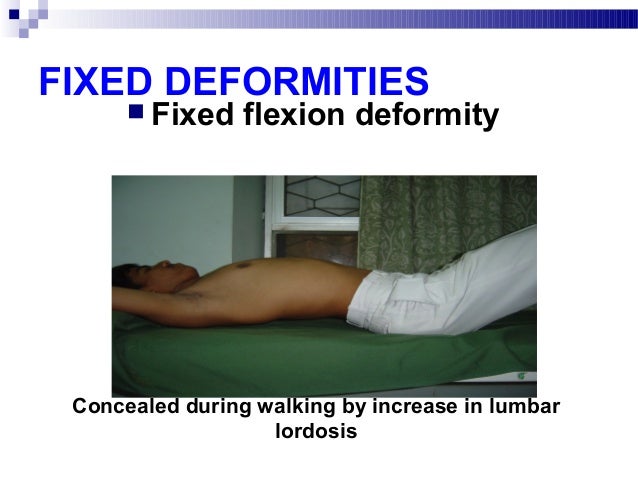 examination of the hip joint